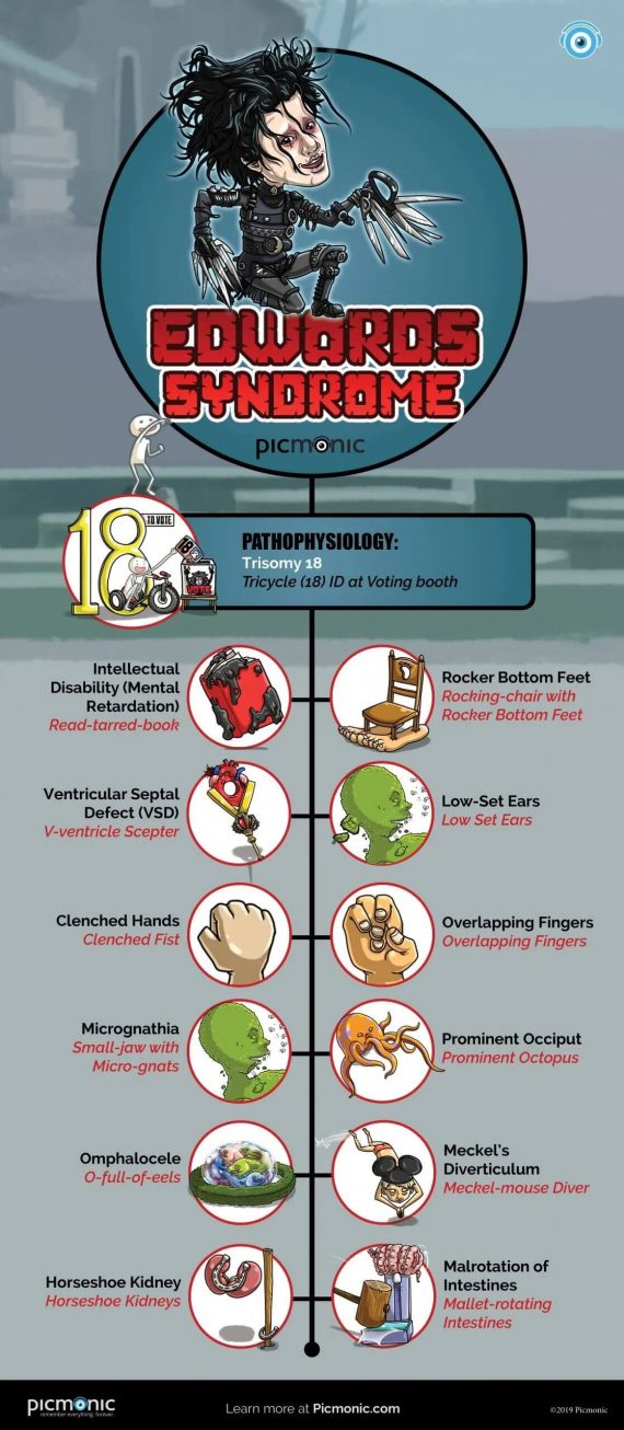 [Infographic] How to Study: Edwards Syndrome | Picmonic