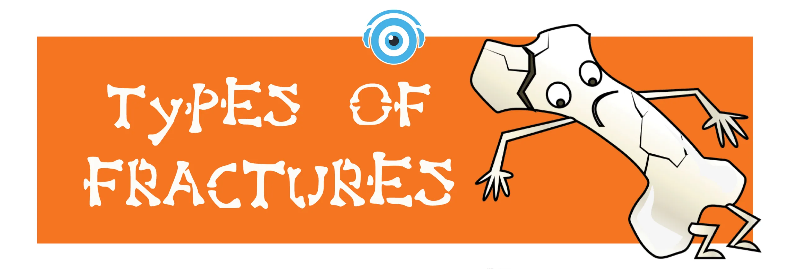 [Infographic] How to Study: Types of Fractures | Picmonic