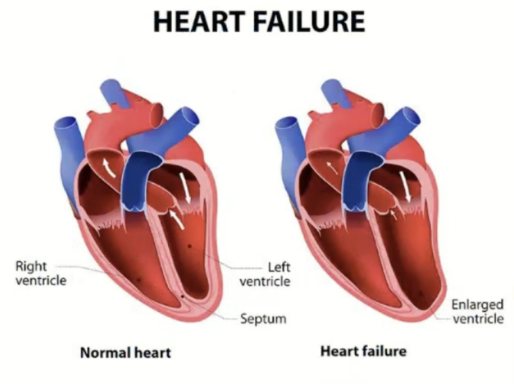 How to Study for Med-Surg and Pharmacology in Nursing School